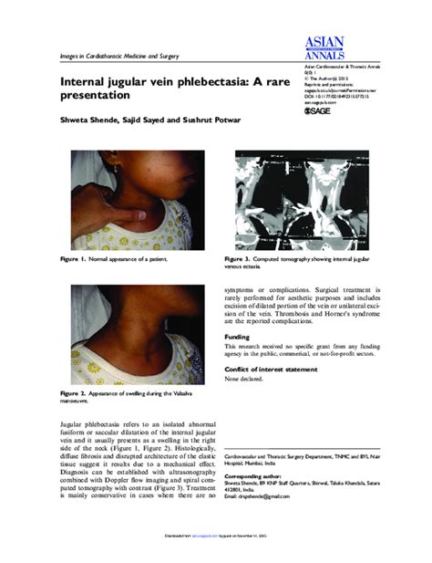 Pdf Internal Jugular Vein Phlebectasia A Rare Presentation