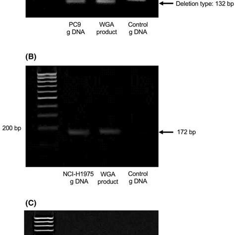 Results Of Electrophoresis For Cells A Pc9 Egfr Exon 19 Deletion Download Scientific