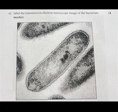 A Label The Transmission Electron Microscope Image Of The Bacterium
