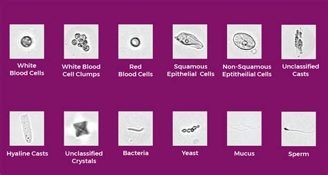 Microscopic Bacteria In Urine