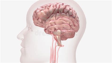 Carotid Artery Stenosis May Go Unnoticed Until A Transient Ischemic Attack Occurs Stock
