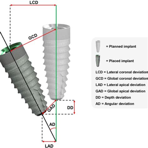 positional deviations between the planned and placed implants
