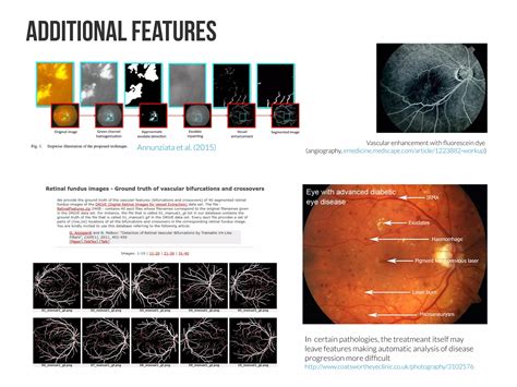 Shallow Introduction For Deep Learning Retinal Image Analysis Pdf Eye And Vision Conditions