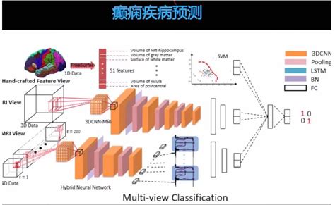 resnet lstm：同时处理空间和时间信息的数据时（如癫痫）的sota算法 resnet lstm csdn博客