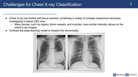 [ns][lab Seminar 240626]gazegnn A Gaze Guided Graph Neural Network For Chest X Ray