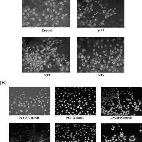 Examination Of Morphological Features Of Apoptosis With Dapi Staining Download Scientific