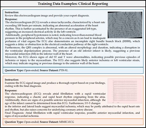PULSE ECG ECGInstruct Datasets At Hugging Face