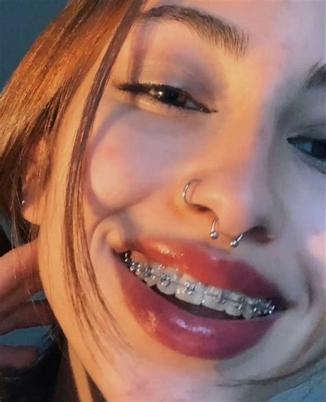 Pin By فاطمة On صورة رمزية Cute Braces Cute Braces Colors Braces Girls