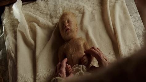 بنت بتتولد بشعر تشبه الأسد وتتعرض للتنمرفي المدرسه لكن فجأة حياتها