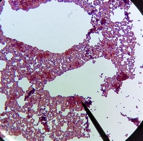 Solved Is This Cocci Gram Negative Or Gram Positive