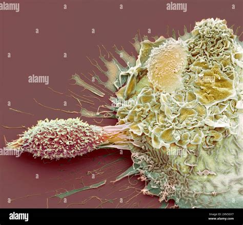 Macrophage And T Cell Coloured Scanning Electron Micrograph Sem Showing The Interaction