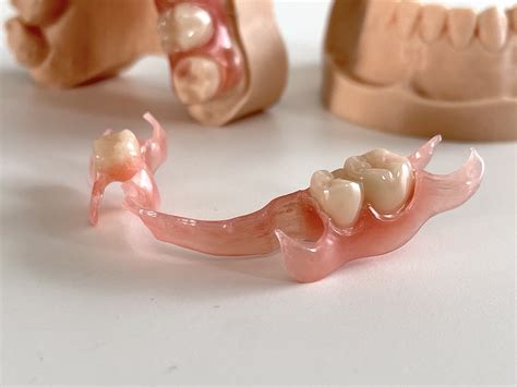 What Are Flippers For Teeth Resetsmile