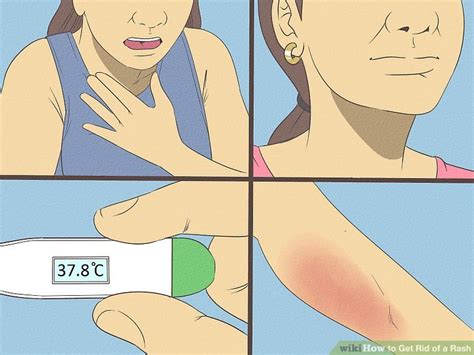 3 Ways To Get Rid Of A Rash WikiHow