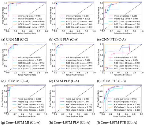 subject specific cognitive workload classification using eeg based