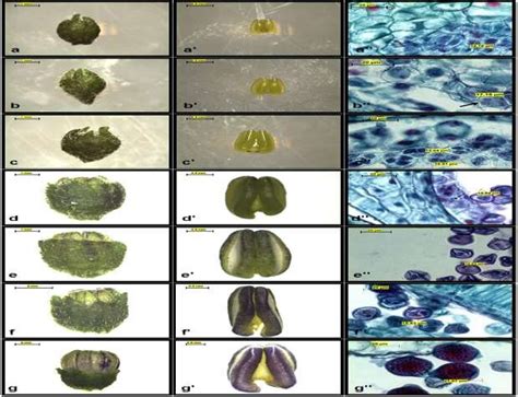 Relationship Between Morphological Indicators And Microspore Download Scientific Diagram