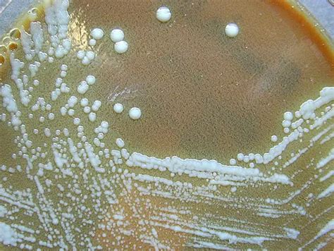 Coccobacilli Gram Negative Bacteria