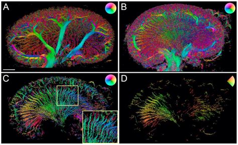Super Resolution Microbubble Track Maps A Unfiltered Microbubble
