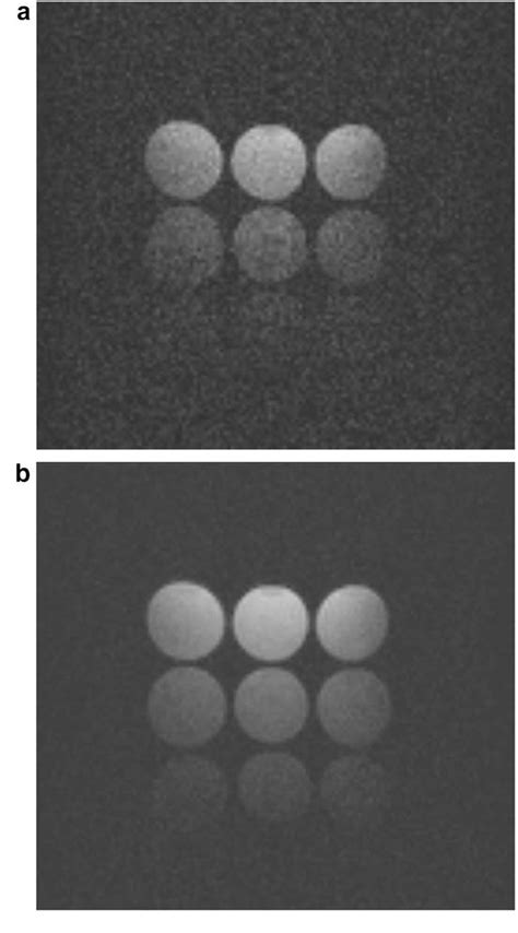 Figure 1 From Cryogenic Receive Coil And Low Noise Preamplifier For Mri At 0 01t Semantic Scholar