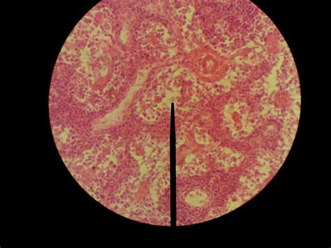 Reticular Tissue Lymph Node Lymph Node Reticular Fibres By Science