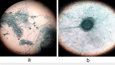 Microscopic Findings Direct Microscopic Examination Showing Septate Download Scientific Diagram