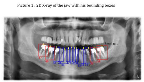 how to match 2d curve in 3d volume image analysis image sc forum