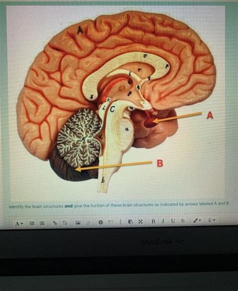Solved Ic A B Identify The Brain Structures And Give The Chegg