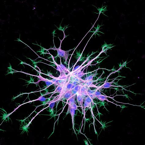 Cytoskeleton Of Neuron Ndrian104