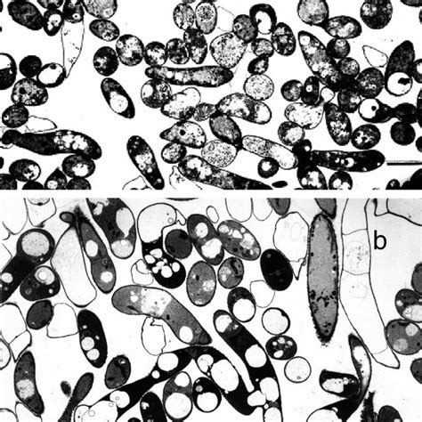 Transmission Electron Micrographs Of Longitudinal Sections Of The Bases