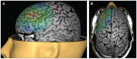 Dr Francis Wayne Quan Memorial Prize 2024 Nexstim
