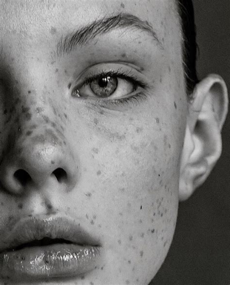 Black And White Portrait And Freckles 💎🌈 Black And White Portraits
