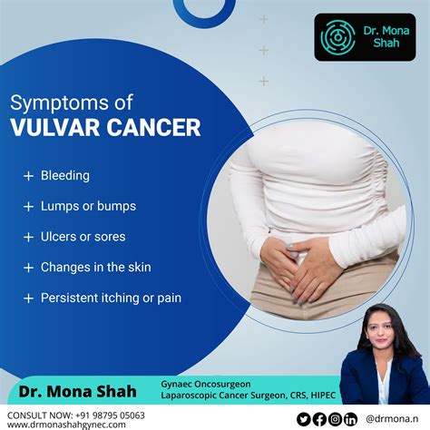 Vulvar Cancer Is A Rare Disease In Which Malignant Cancer Cells Form