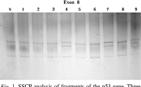 Figure 1 From Analysis Of P53 Somatic Mutation In Head And Neck Cancer Using Denaturing High