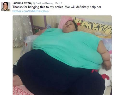 Woman Dubbed ‘worlds Fattest Woman To Get Operation