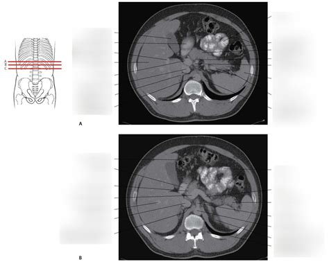 Ct Scan Cross Section Diagram Quizlet
