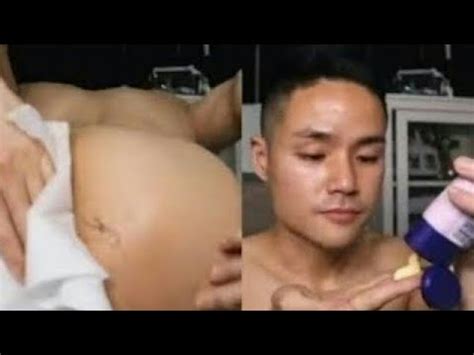 Kevin Leonardo Nair Butt Hair Removal Video New Video Youtube