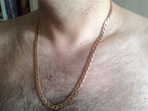 Бисмарк На Шее Фото —