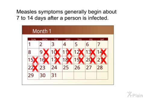 Measles