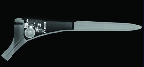 Additive Manufacturing For Smart Body Implants Machine Insider