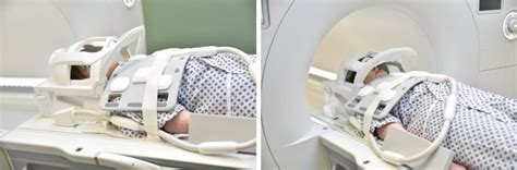 Thymus Mri Thymic Cyst Mri Protocol And Planning Thymoma Mri