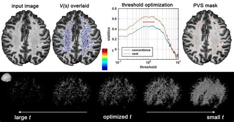 Automated Quantification Of PVS Likeliness And PVS Segmentation First Download Scientific