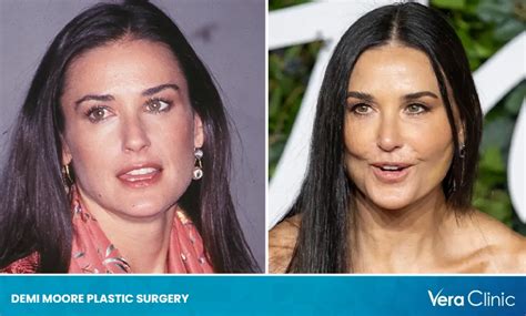 Demi Moore Body Before And After Demi Moore Her Journey Of Addiction