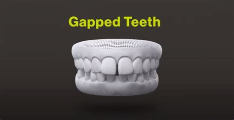 ნინო ბერიძის ორთოდონტიული ცენტრი