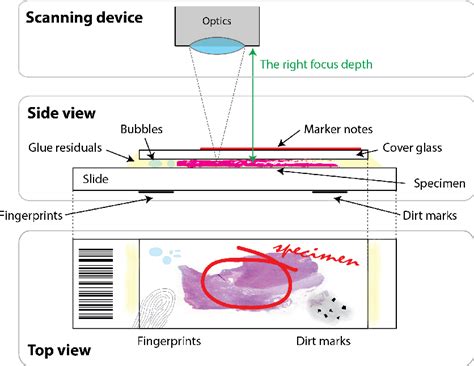 Figure 1 From Artifact Augmentation For Enhanced Tissue Detection In