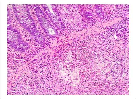 Hematoxylin And Eosin Hande Stain Demonstrating Gastrointestinal Mucosa Download Scientific