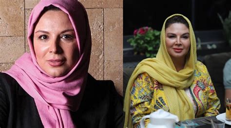 خبرآنلاین عکس تغییر چهره عجیب شهره سلطانی بعد از عمل زیبایی