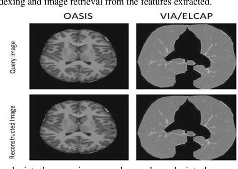Figure 2 From Generative Squeeze Net Unet Model For Image Reconstruction Semantic Scholar