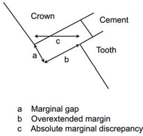 Figure 1 From The Significance Of Marginal Gap And Overextension