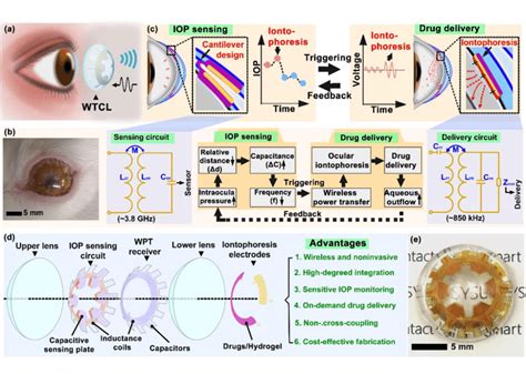 Schematic Of The Wtcl For Real Time And In Situ Glaucoma Diagnosis And Download Scientific