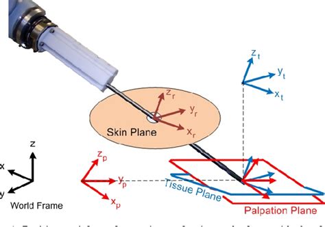 Figure 1 From Remote Palpation To Localize Tumors In Robot Assisted Minimally Invasive Approach