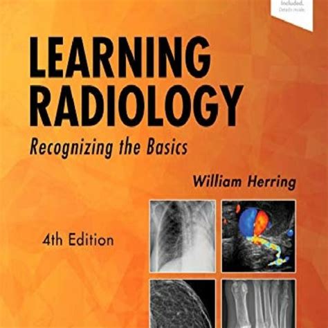 Stream PDF Download Learning Radiology Recognizing The Basics From Dewasa Listen Online For